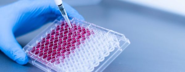 What TEER Measurement Is and Why Laboratories Should Use It – SVI-NEWS